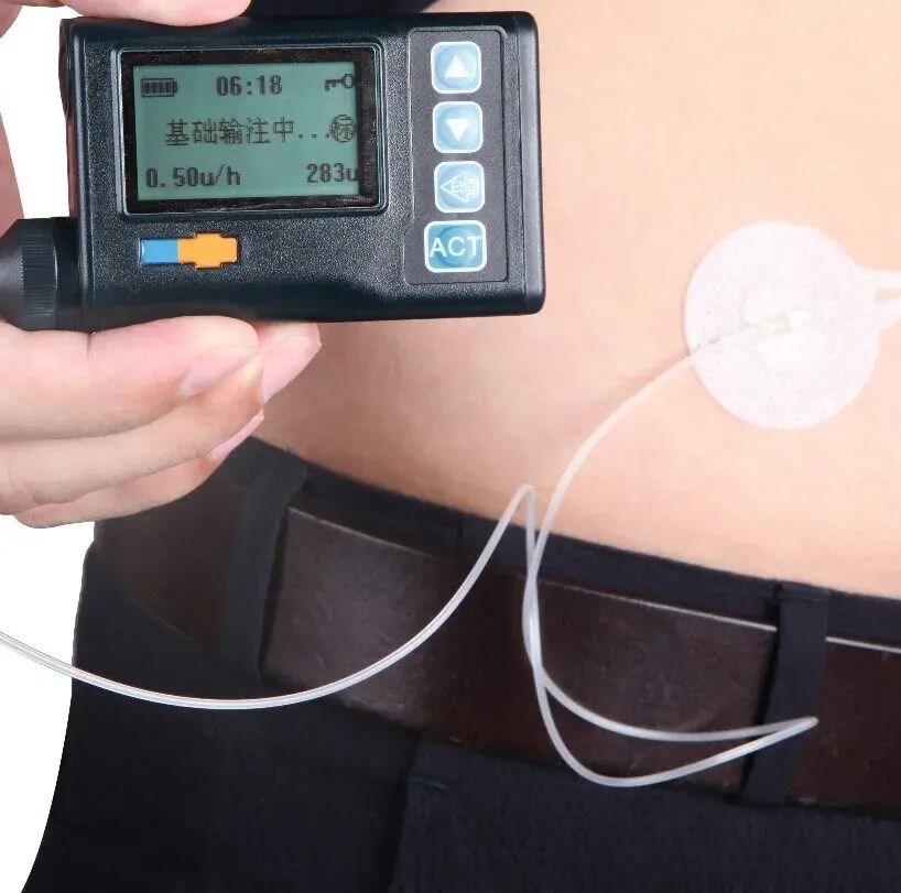 Buy China Wholesale Advanced Smart Insulin Pump For Continuous Insulin ...
