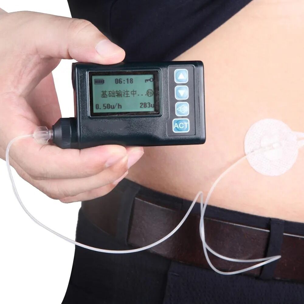 Advanced Insulin Pump For Diabetes Management With Continuous Glucose ...