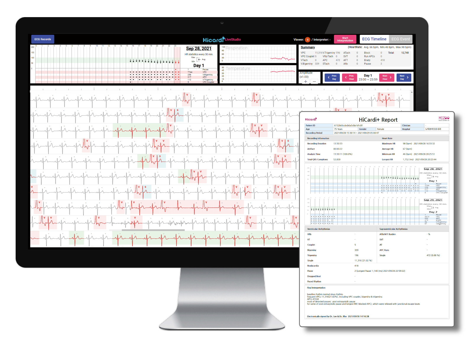 Hicardi+ H100 Is Wearable Ecg Ambulatory Recorder - Buy South Korea ...