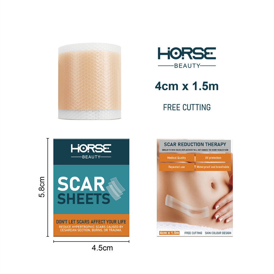 Private Label Horse 3 Meter Silicone Scar Remover Roll Skin Care Acne ...