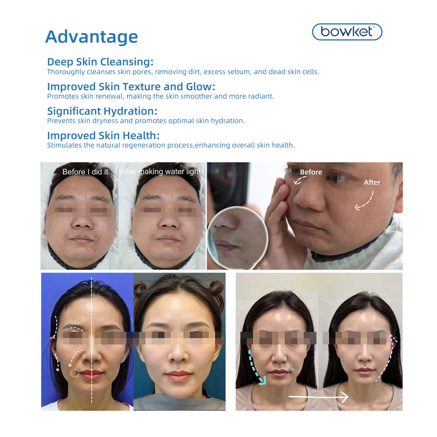 Bowket 17 In 1 Hydro-facial-microdermabrasion-machine Pore Clean Skin ...