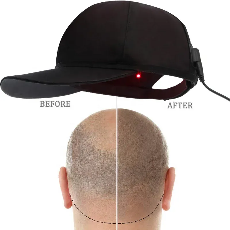 Wholesale Red Light Therapy Cap Infrared Led Heat Hat For Home Use ...