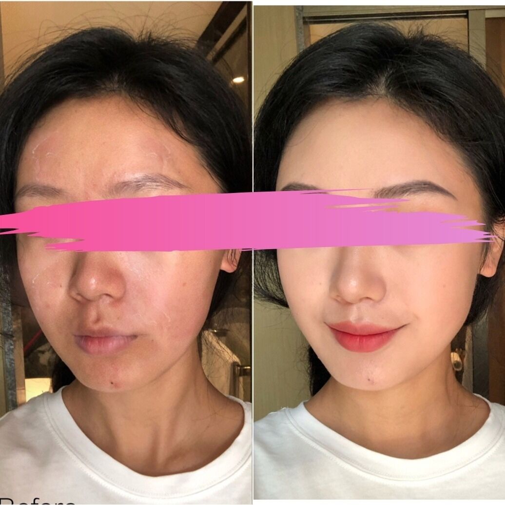 Facial Care, Remove Wrinkles And Dullness Tripeptide-1 Copper Peptide ...
