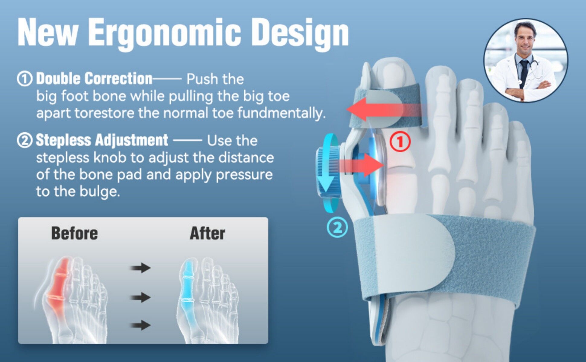 Big Toe Valgus Corrector, Adjustable Rotation, Overlapping Toe Splitter ...