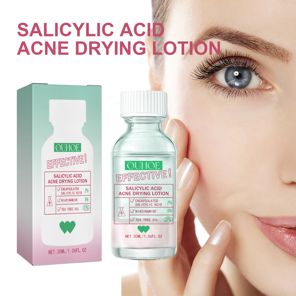 Bulk Buy China Wholesale Ouhoe Salicylic Acid Acne Drying Lotion ...