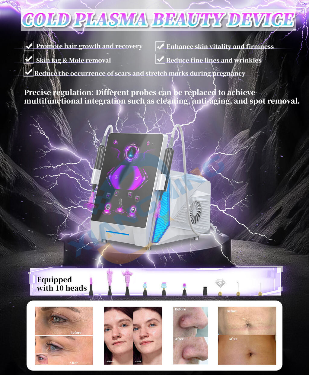2-in-1 Hot & Cold Plasma Machine - Wrinkle & Wart Removal $500 ...